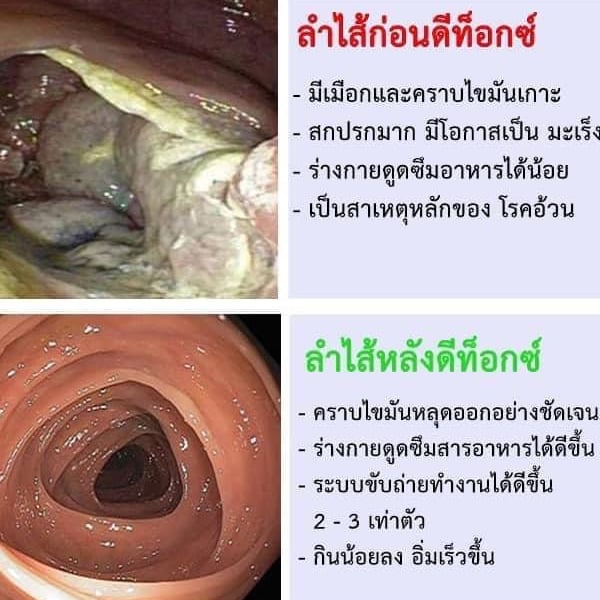 ดีท็อกซ์ล้างสารพิษ วีไฟเบอร์ (Wefiber) 1 กล่อง บรรจุ 14 ซอง